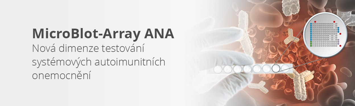 Vývoj, výroba a distribuce humánní a veterinární laboratorní ...